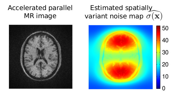 Spatially variant noise estimation in MRI - IEEE Transactions on ... Spatially variant noise estimation in MRI - IEEE Transactions on ...