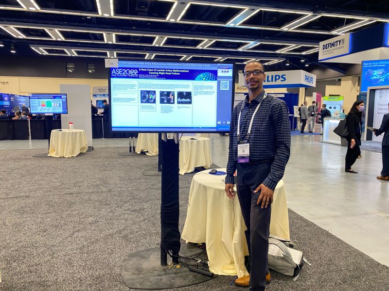 Billy Cathey, RDCS on LinkedIn: Very proud to have a abstract selected ... Billy Cathey, RDCS on LinkedIn: Very proud to have a abstract selected ...