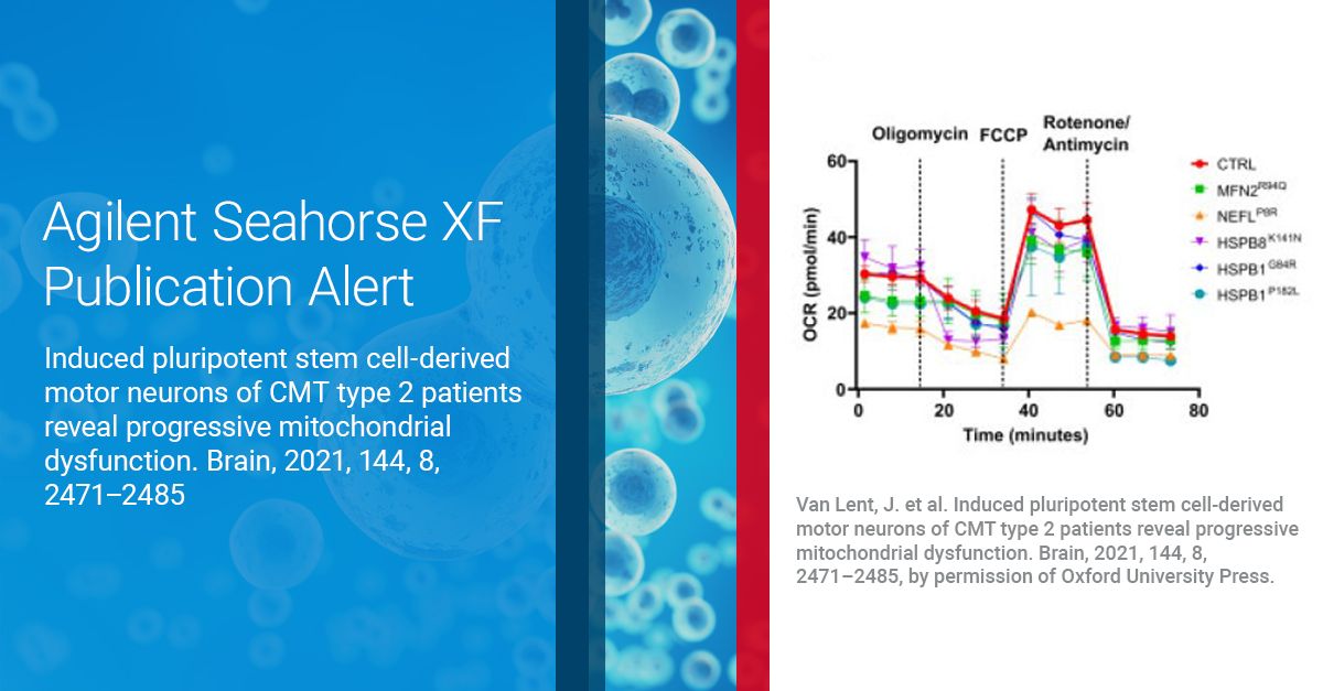 Agilent Cell Analysis auf LinkedIn: Cell Metabolism Publication Alert Agilent Cell Analysis auf LinkedIn: Cell Metabolism Publication Alert