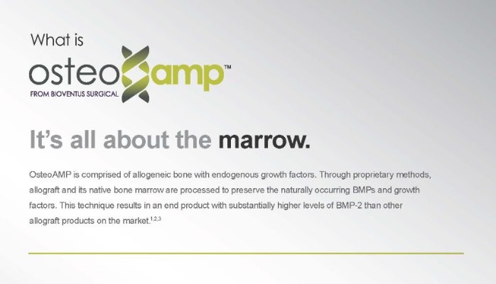 Come see us at NASS, booth #741. Learn about the OsteoAMP difference. Come see us at NASS, booth #741. Learn about the OsteoAMP difference.