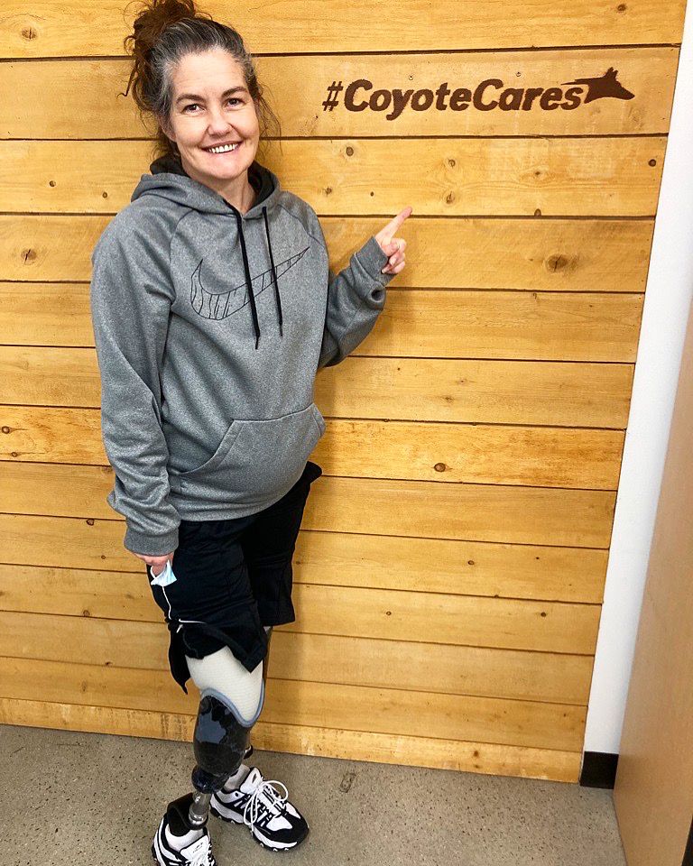 Jennifer Fayter on LinkedIn: #prosthetics #orthotics #amputee Jennifer Fayter on LinkedIn: #prosthetics #orthotics #amputee