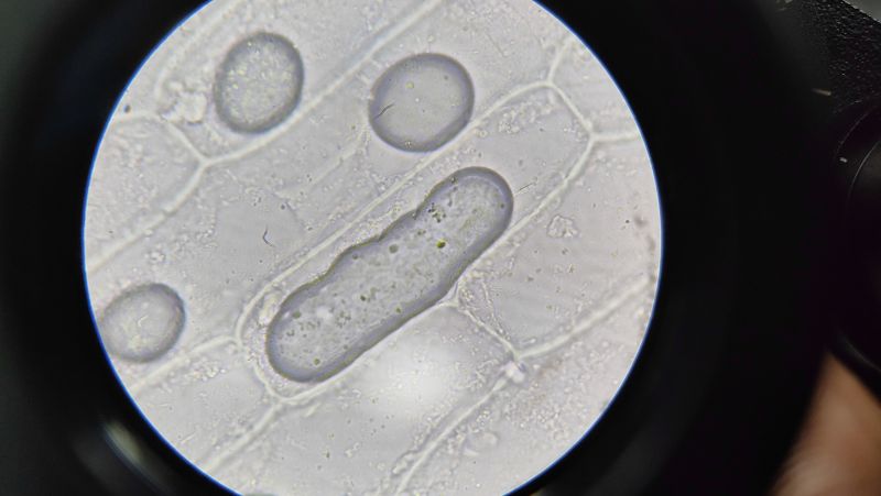 Md.Emam Hasan on LinkedIn: #microbiologist #microscope #cell Md.Emam Hasan on LinkedIn: #microbiologist #microscope #cell