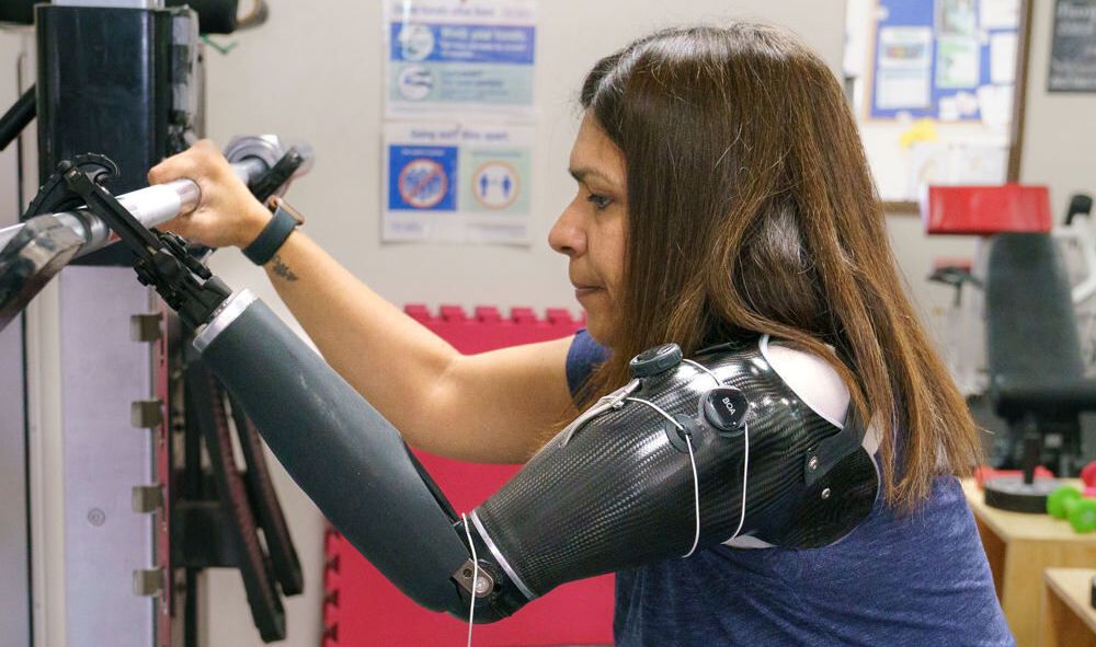 Arm Dynamics on LinkedIn: Claudia Castellanos | Patient Profile | Arm ... Arm Dynamics on LinkedIn: Claudia Castellanos | Patient Profile | Arm ...